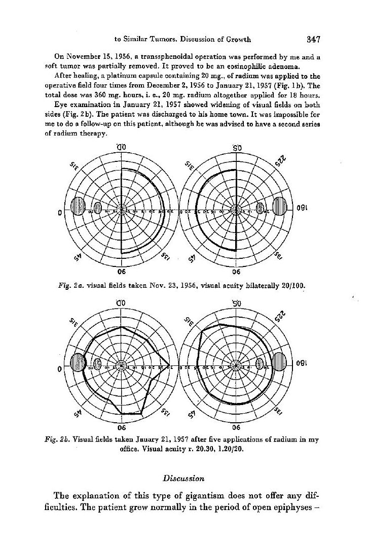 Adam Rainer - The tallest man Austria