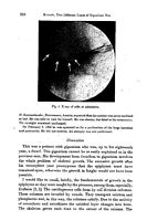 Adam Rainer - The tallest man Austria