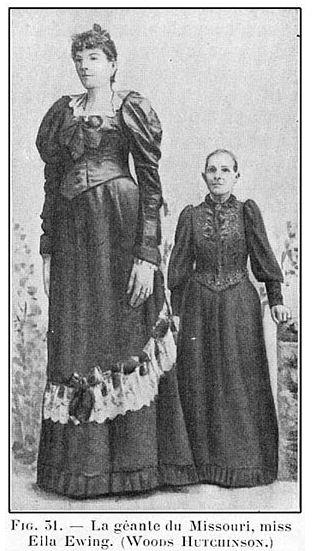 Ella Ewing The tallest woman Missouri