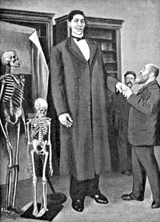 Feodor Machnow - The tallest man Russia Belarus