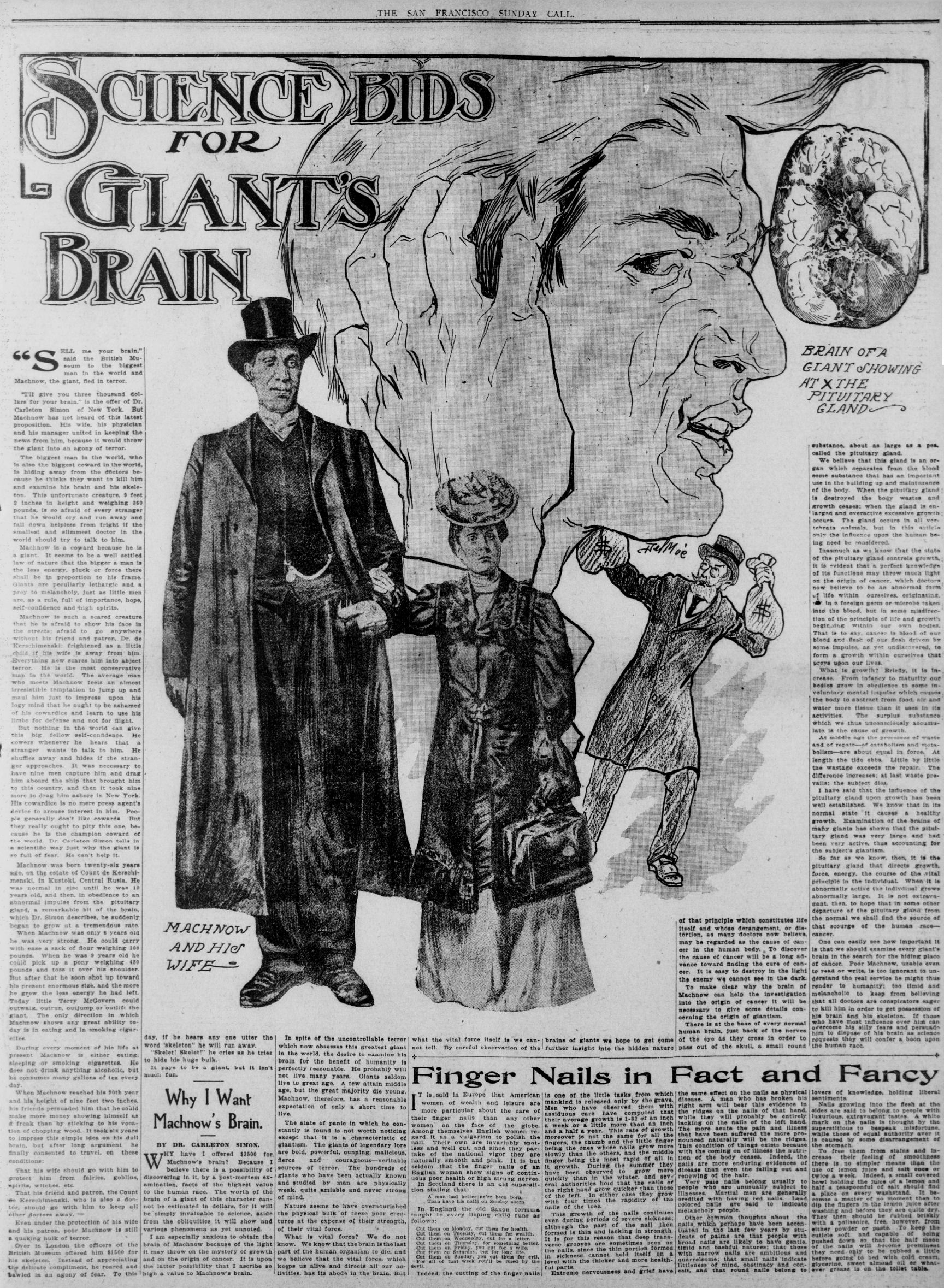 Feodor Machnow - The tallest man Russia Belarus