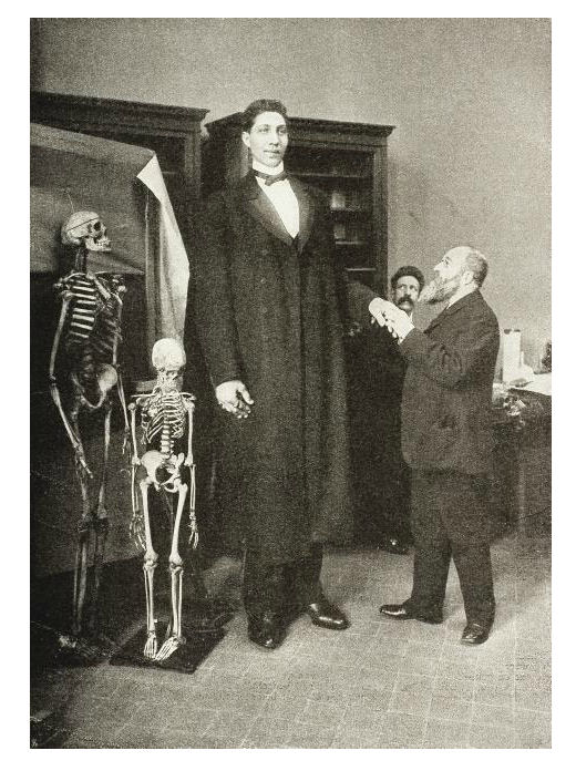 Feodor Machnow - The tallest man Russia Belarus