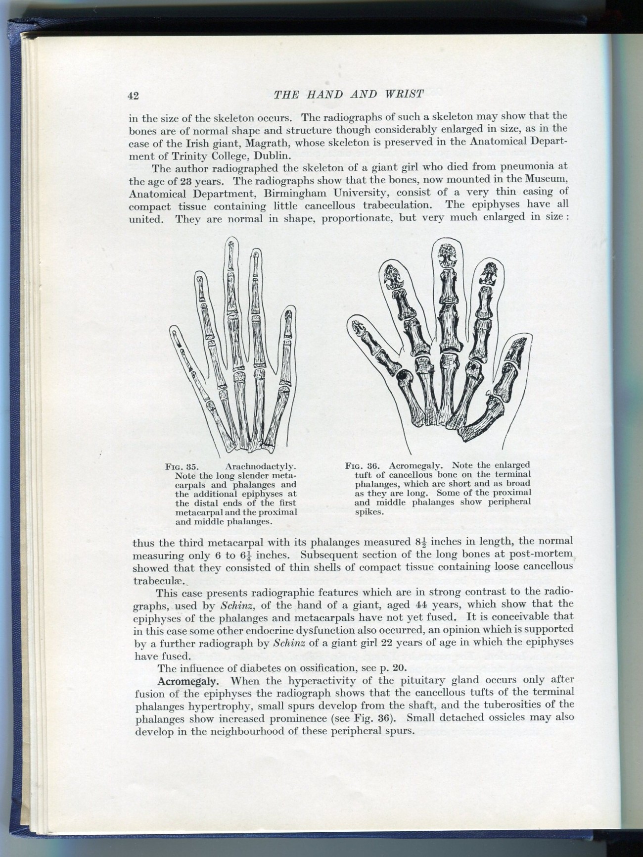 Jane Ginny Bunford The tallest woman