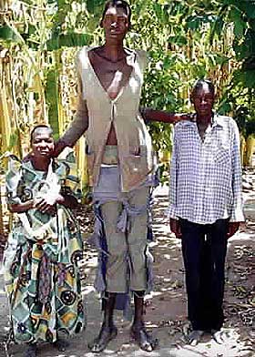 John Paul Ofwono - The tallest man Uganda