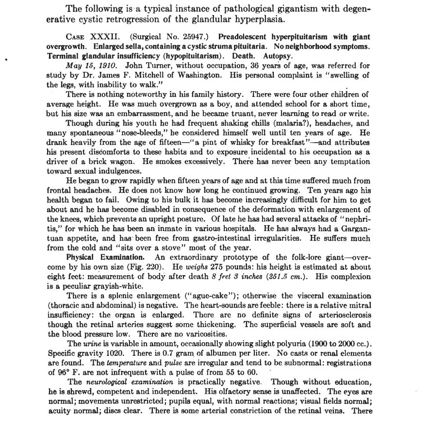 John Turner - The tallest man