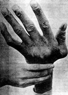 John William Rogan The tallest man Tennessee Bud