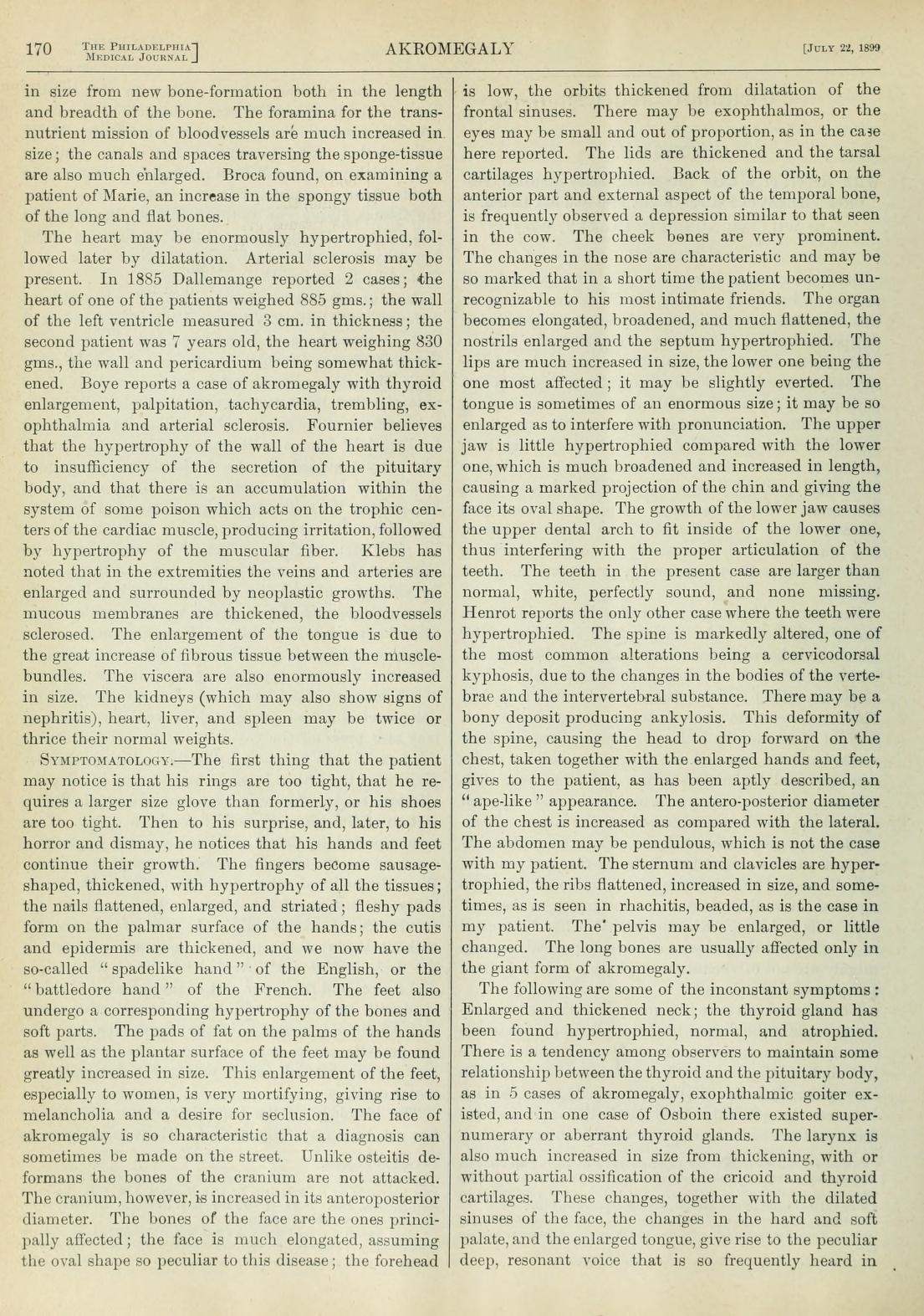 John William Rogan The tallest man Tennessee Bud