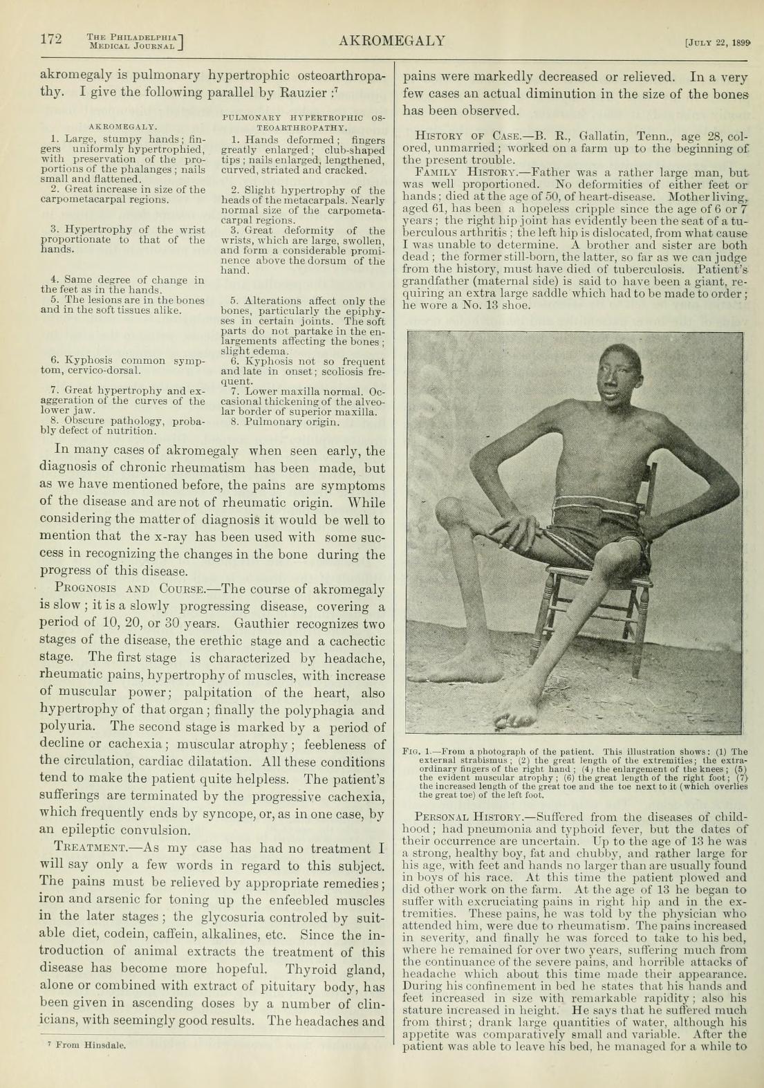 John William Rogan The tallest man Tennessee Bud