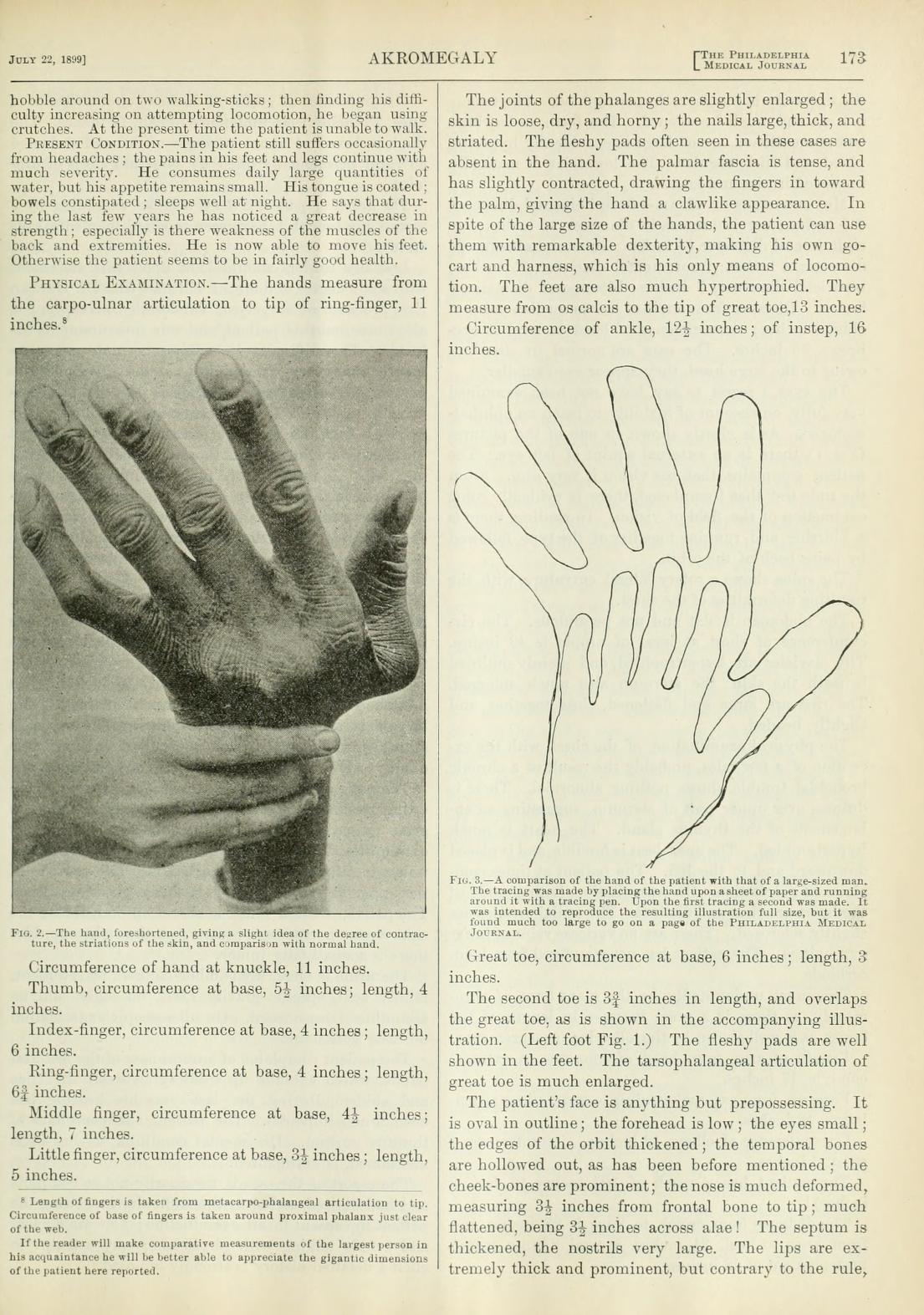 John William Rogan The tallest man Tennessee Bud