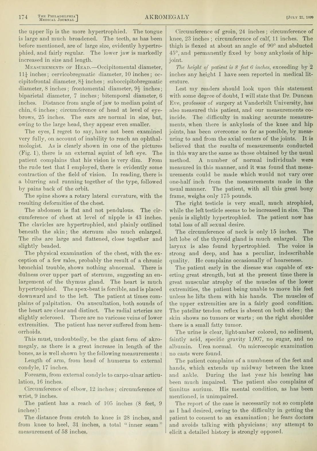 John William Rogan The tallest man Tennessee Bud