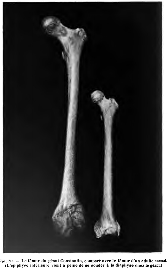 Julius Koch - Le geant Constantin The tallest man Mons