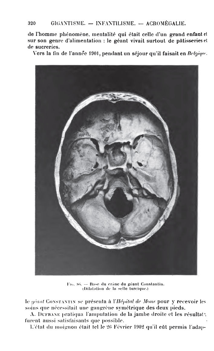 Julius Koch - Le geant Constantin The tallest man Mons