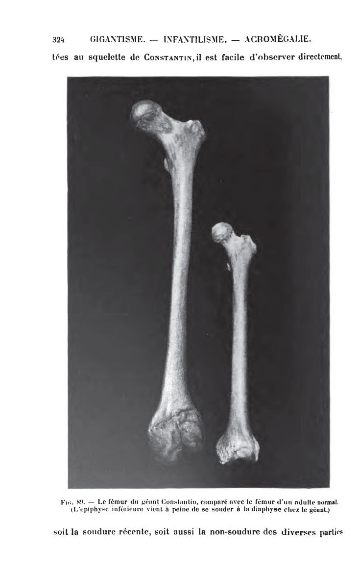 Julius Koch - Le geant Constantin The tallest man Mons