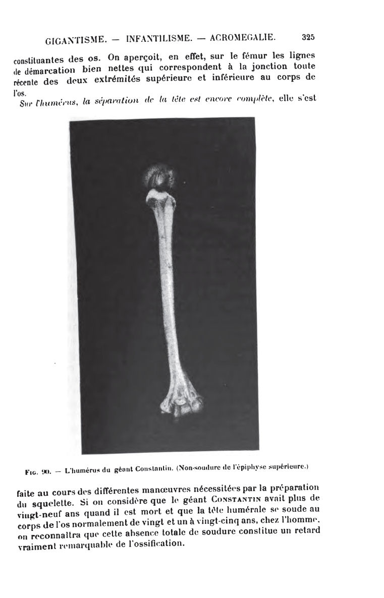 Julius Koch - Le geant Constantin The tallest man Mons