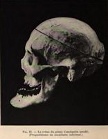 Julius Koch - Le geant Constantin The tallest man Mons